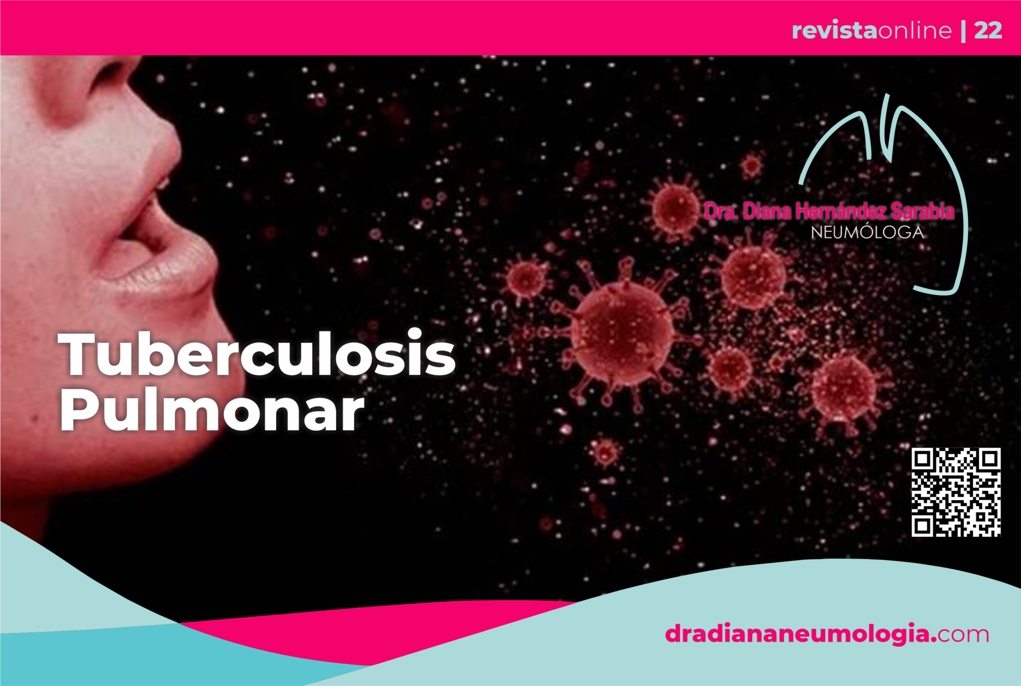 Tuberculosis Pulmonar - Dra. Diana Hernández Sarabia